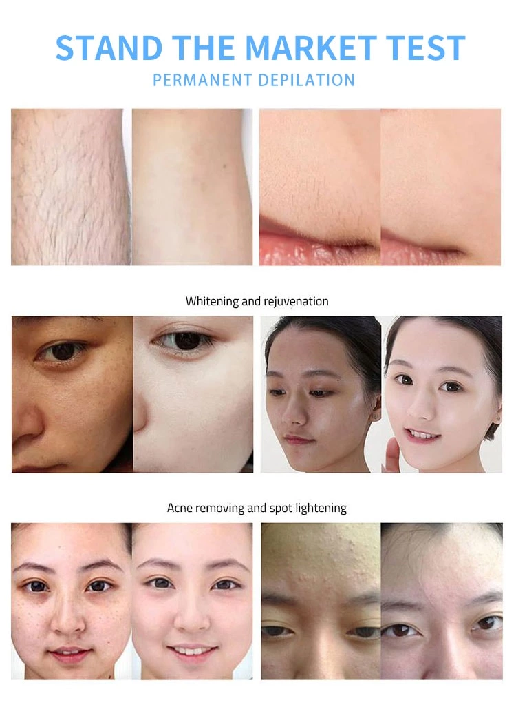 IPL OPT Hautverjüngung Lumenis M22 Maschine Gefrierpunkt aopt Laser Haarentfernung Gerät Gerät ...